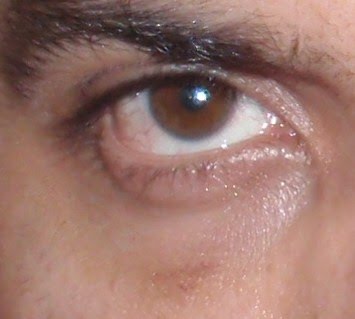 Blog Lunaro: HISTORIA DE UN OJO MORADO (8)