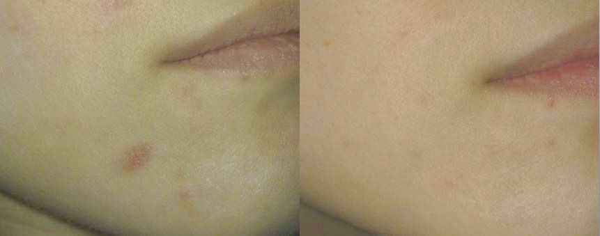 Breakthrough in Healthcare & Aesthetics: DermAureus - The Latest ...