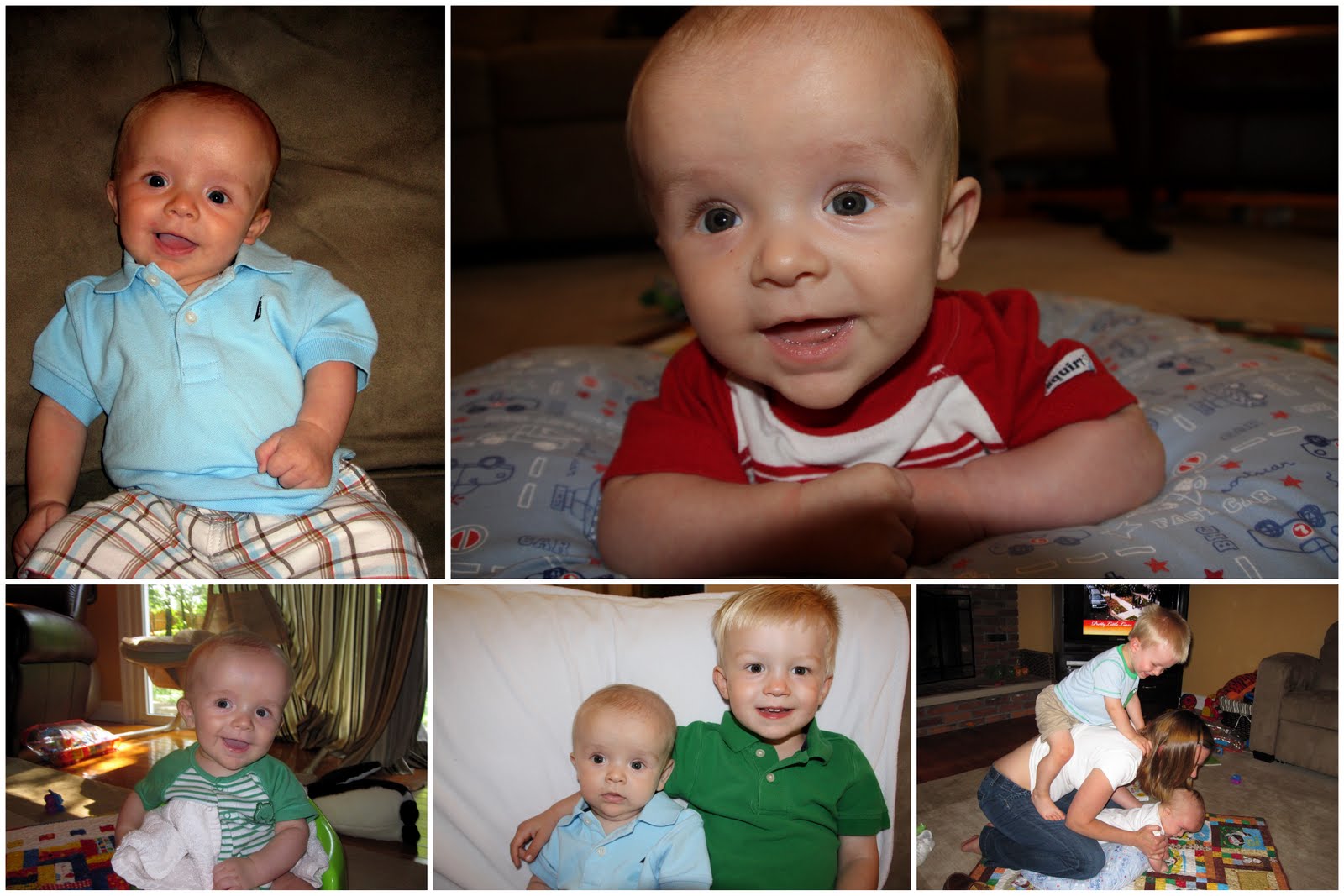 Megalencephaly Macrocephaly | The Transmitter: Neuroscience News And