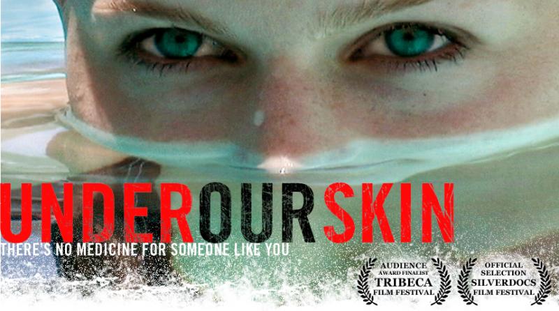 Co. Infektioner | Snegleliv's Weblog