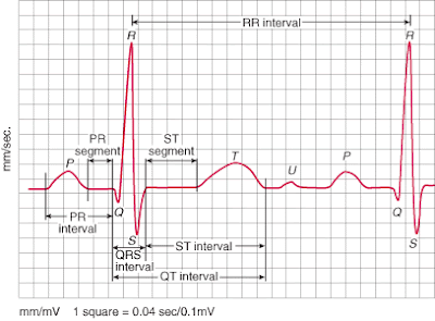 Medical Lecture Notes Online: ECG 2 -How to Analyze a Rhythm
