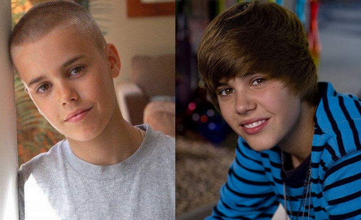 Baratolouko: Justin Bieber careca!