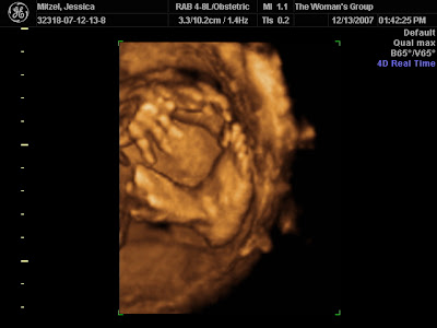 The Mitzels: 4D Ultrasound-27 weeks 5 days