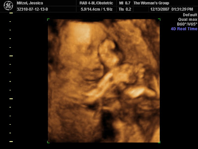 The Mitzels: 4D Ultrasound-27 weeks 5 days