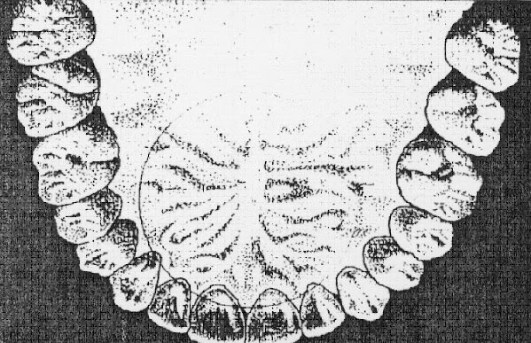 Odontología Forense: LAS RUGAS PALATINAS COMO HERRAMIENTA IDENTIFICATORIA