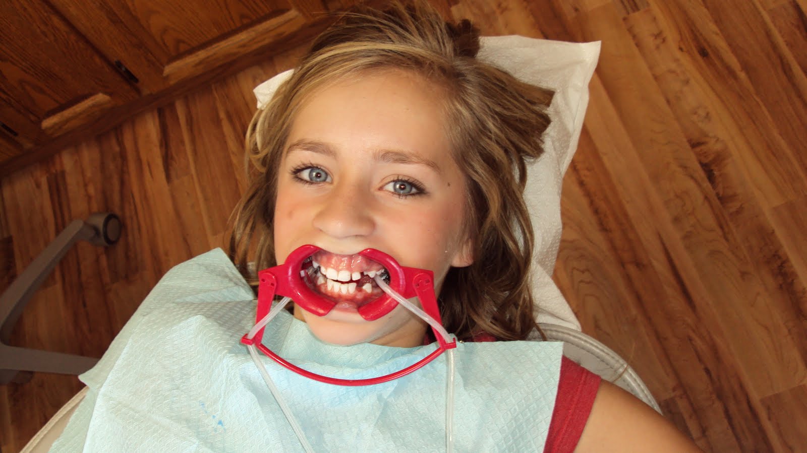 Good Looking People With Braces
