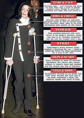 New Spicy Hot Trends: michael jackson autopsy leaked
