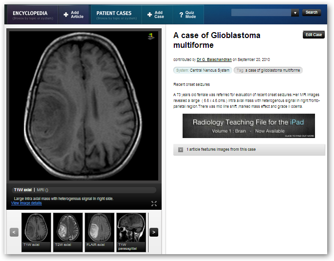 enero 2011 ~ Un Mapache