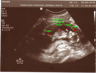 The Next 40 Weeks: A Blog for First Time Moms: 13 Weeks 5 Days