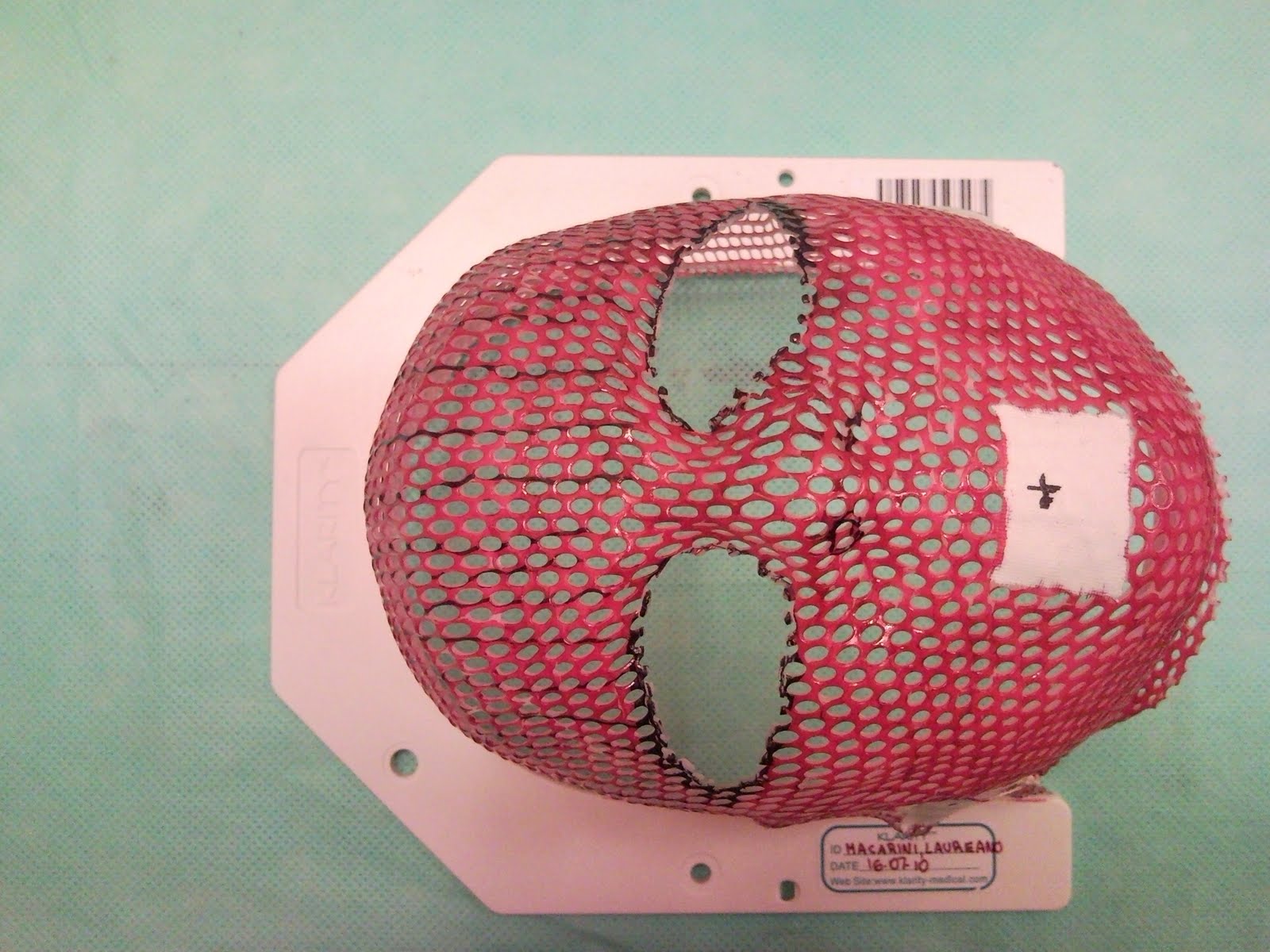 Atención Pediátrica en Radioterapia: Fotos de máscaras termoplásticas