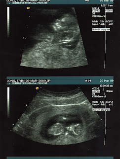 The Long Family: Baby Long's First Photos