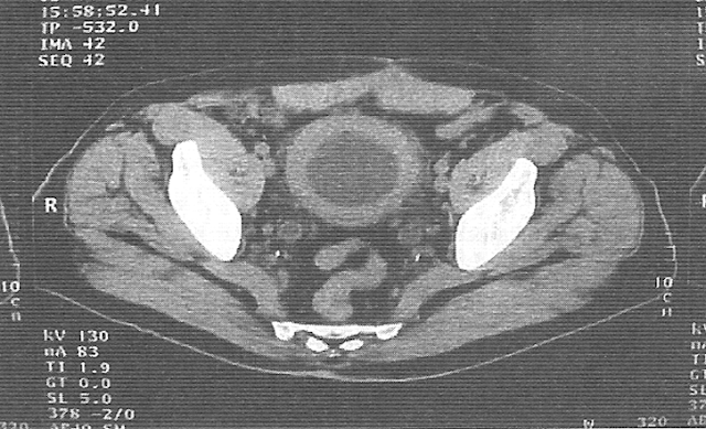 EL RINCÓN DE LA MEDICINA INTERNA. juanpedromacaluso@yahoo.com.ar ...