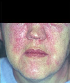 EL RINCÓN DE LA MEDICINA INTERNA. juanpedromacaluso@yahoo.com.ar ...