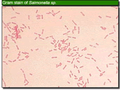 Bacterias Patológicas: "Salmonella"