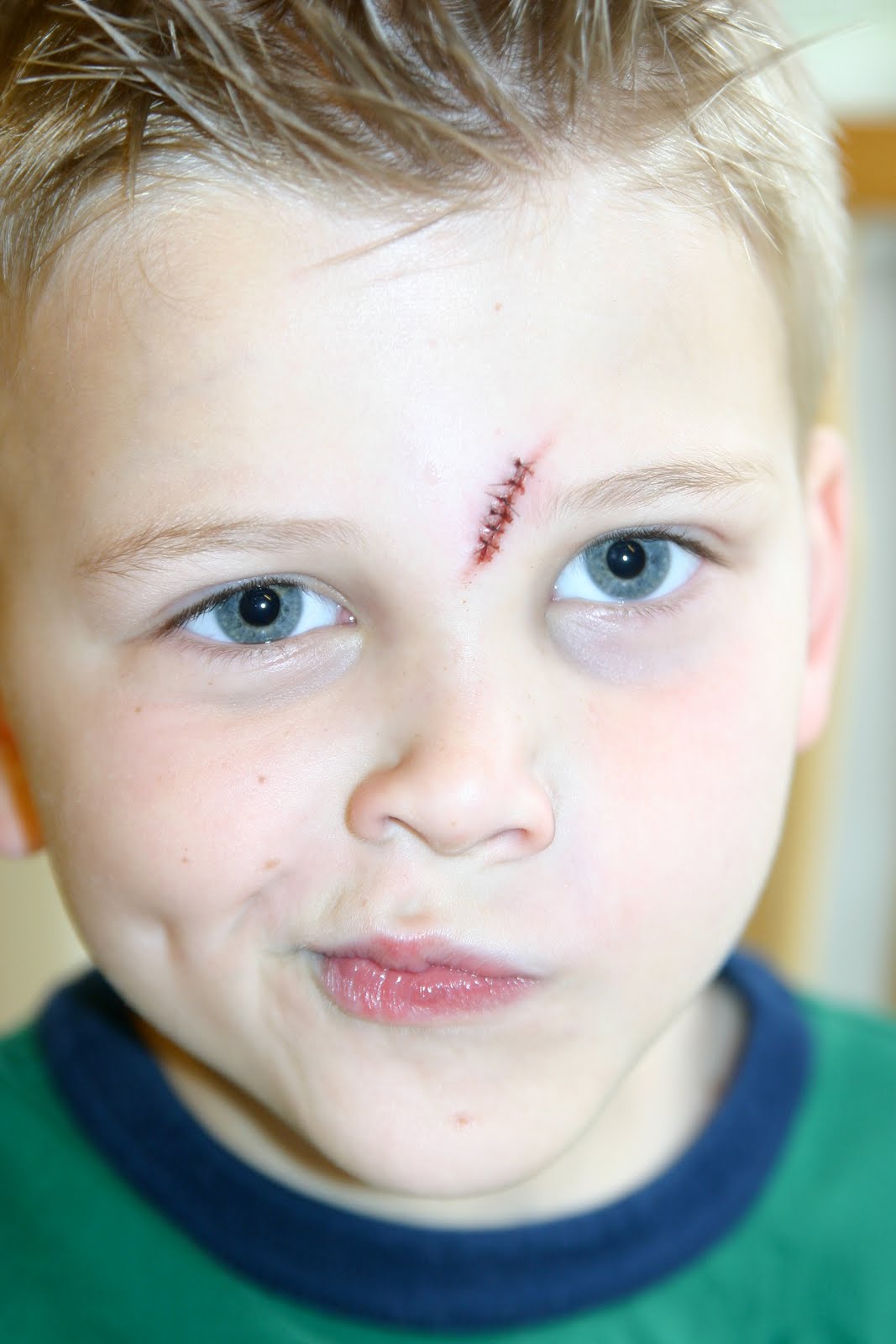 The Wild West: I got a crack in my head!