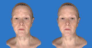 Small ideas for a big world: Virtual Plastic Surgery