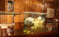 The Mütter Museum - Collection of Medical Oddities | It's Just Philly