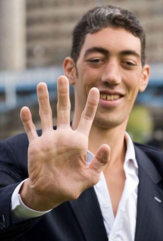 Sultan Kosen tallest man from Turkey