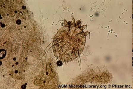 CIENCIAS BIOLOGICAS: SARNA (escabiosis)