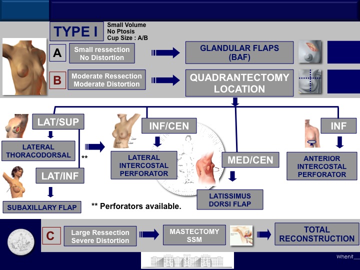 Reconstrução Mamária: Oncoplastic Surgery Panel - Toronto 2010