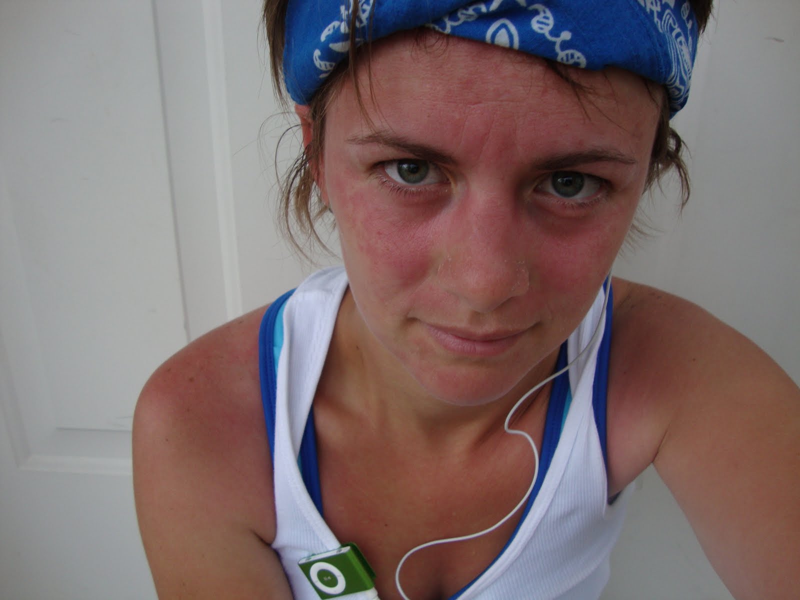 vanessa jane: last wednesday: splotchy face syndrome