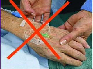 ROTINSULUNURSE: INFUS FLEBITIS/BENGKAK