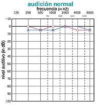 Oídos libres: Hipoacusia inducida por ruido