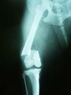 Traumatologia y Cirugia Ortopedica Veterinaria: FRACTURA DISTAL DE ...