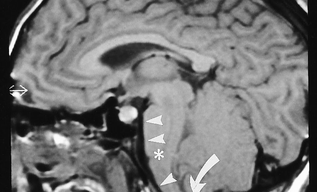 MEDICINA INTERNA HGM