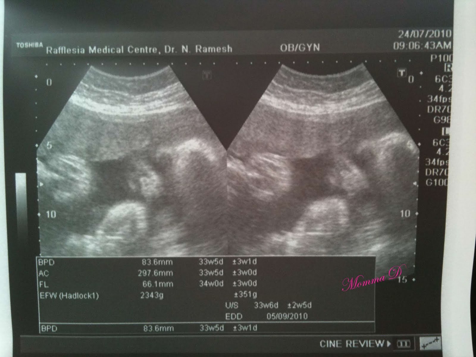 Madre D - Say WHAT?!: Baby at 34 weeks and preparing for the upcoming ...