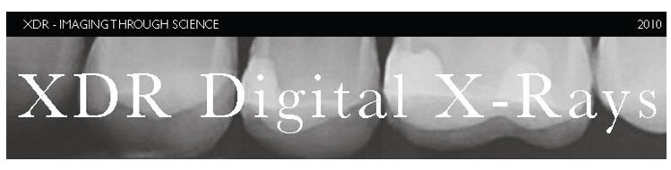 Dental X-Ray Sensors XDR.. Leading The Way...
