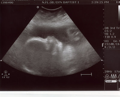 One Wink Studios: Ultrasound 31 Weeks