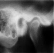 Radiography: Linear Tomography