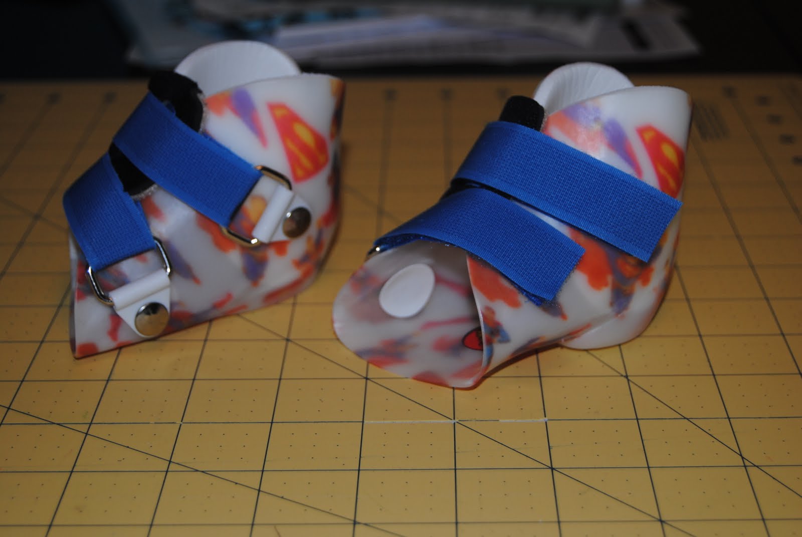 Surviving Triplets: Ian's new "braces"...SMO's.