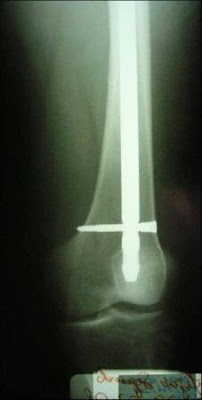 CAMTA Mission 2012: Celebrating 10 years of Partnership: CAMTA ...