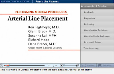 UTIPEDIATRIA SAN BARTOLOME: Linea Arterial (video del nejm)