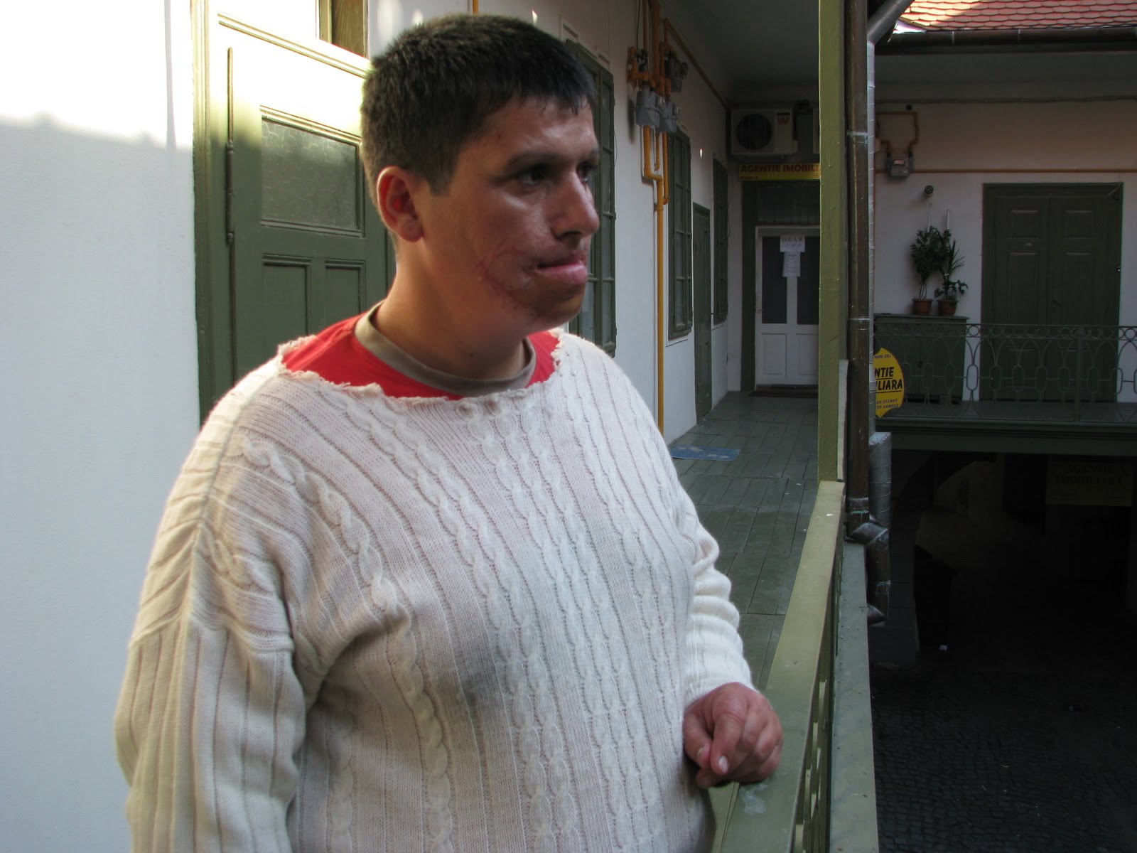 ADEVĂRUL VERDE ÎN FAŢĂ: EL ESTE PRIMUL ROMAN FARA ORGANE GENITALE