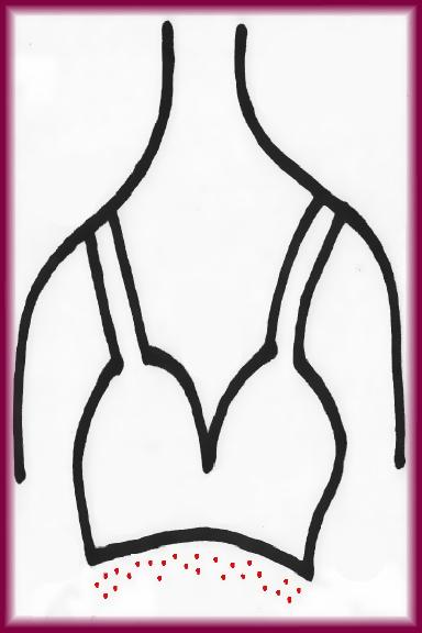 Your Breast Friend: Bra Issues