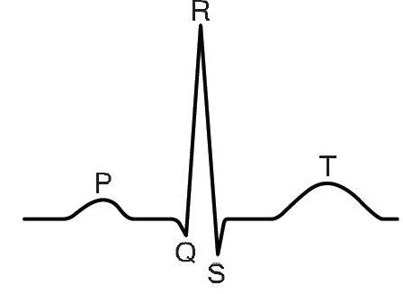 Kembara di bumi Malaysia: Interpreting Electrocardiogram (ECG)