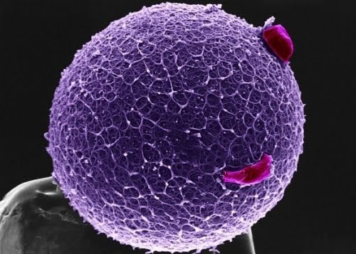 ORGANISMUL UMAN: Organele sexuale femeiesti