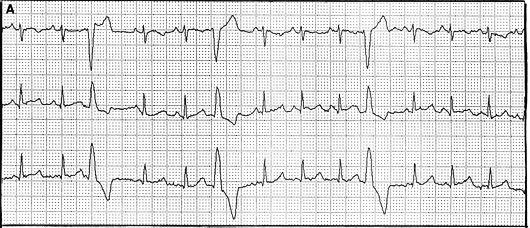 My medical blog: Belajar EKG