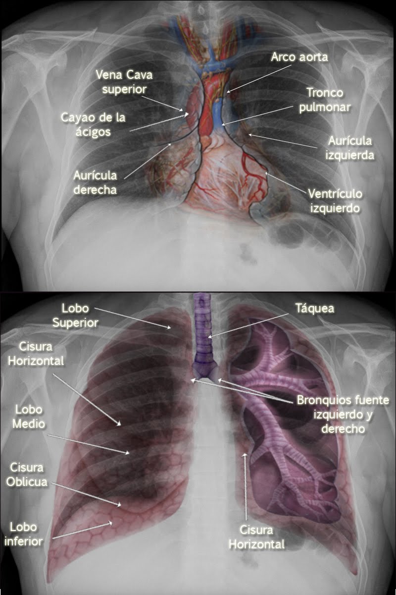 Portafolio Digital: Radioshop: Radiografía de Tórax