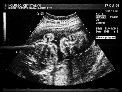 The Orange House: 25 week ultrasound