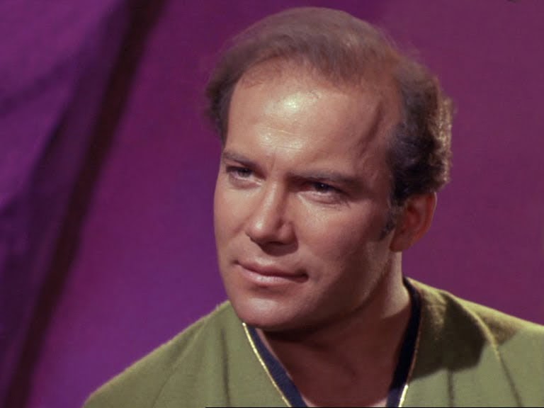 Shatner's Toupee: The William Shatner baldness estimation challenge.