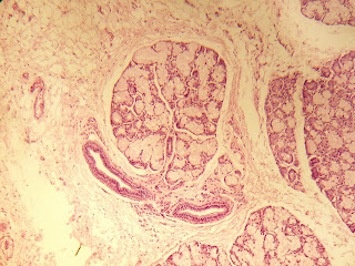 HISTOLOGIA DE LA BOCA: GLÁNDULAS SALIVALES PRINCIPALES