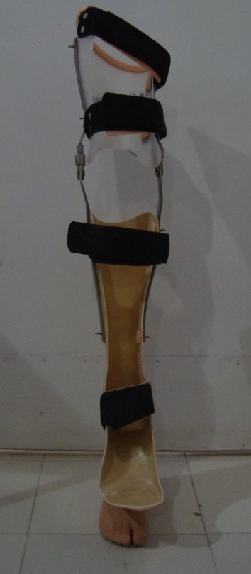 osteo support: SHORTENING AND COMPENSATION