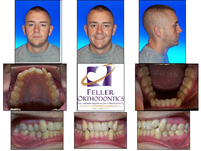 Feller Orthodontics