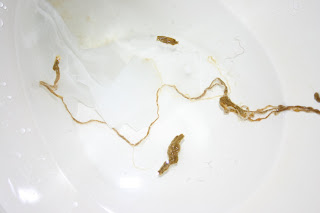 Parasitses: REAL LIFE PARASITES