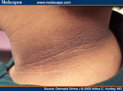 A new day A new experience: Dirty Necks--Black Beads