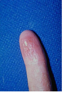 Dermatology: Dermatology